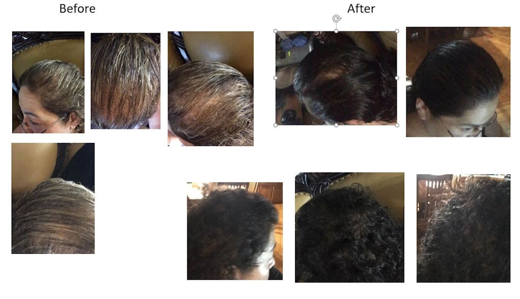 FoliGrowth Ultra Hair Growth Vitamin with high potency Biotin ...