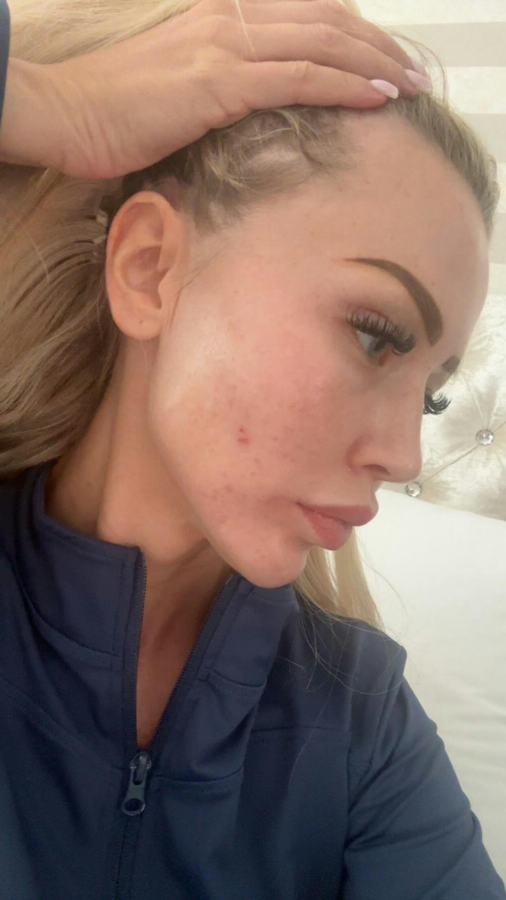 Clear Skin Complex - Aegle's