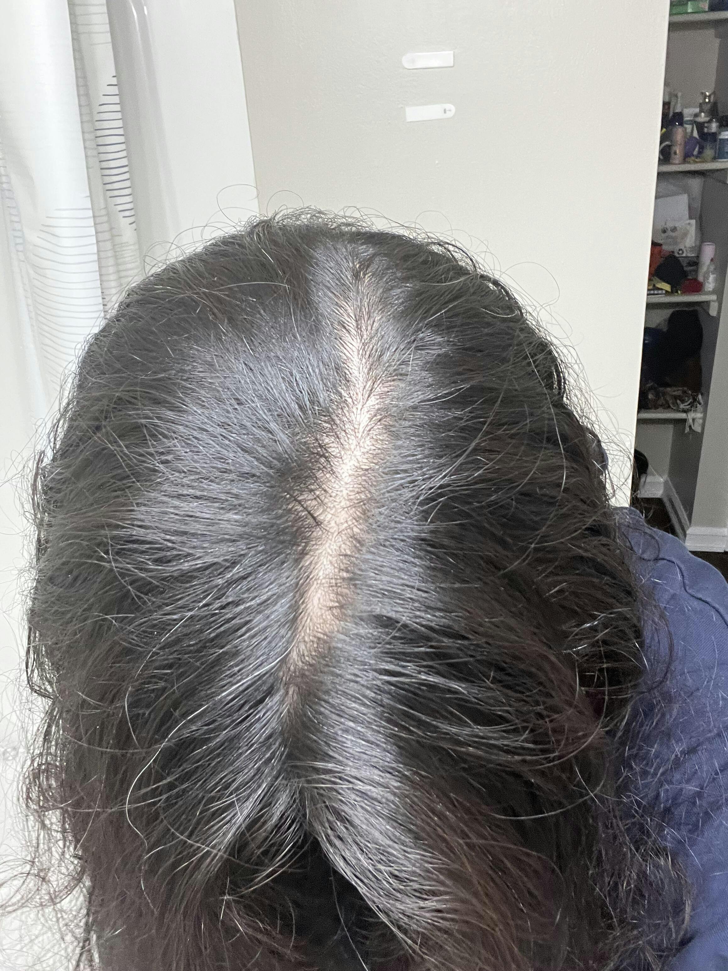 AMAZING HAIR SAVIOUR & AMAZING SCALP SAVIOUR COMBO – Amazing Hair Saviour