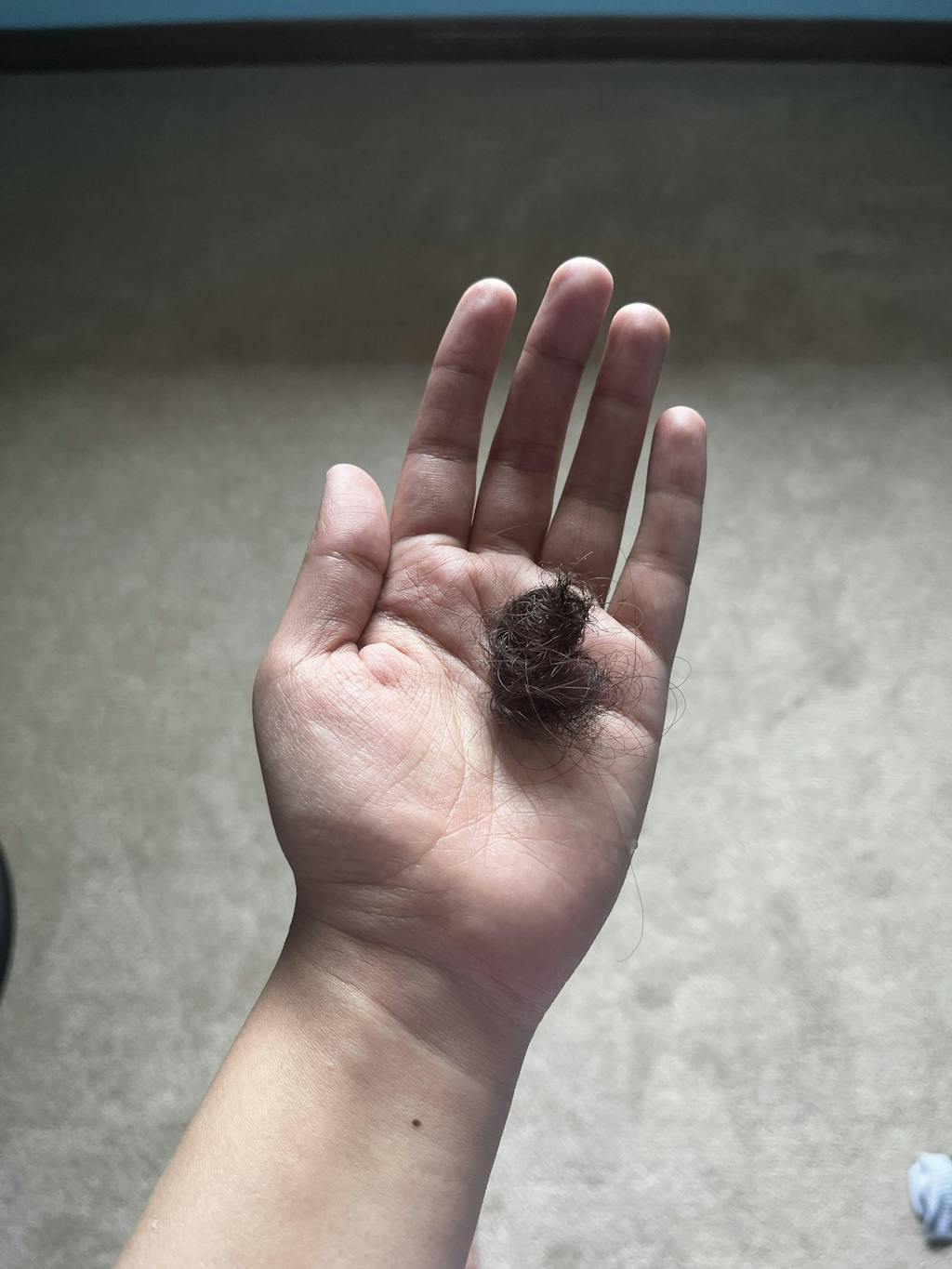 AMAZING HAIR SAVIOUR & AMAZING SCALP SAVIOUR COMBO – Amazing Hair Saviour