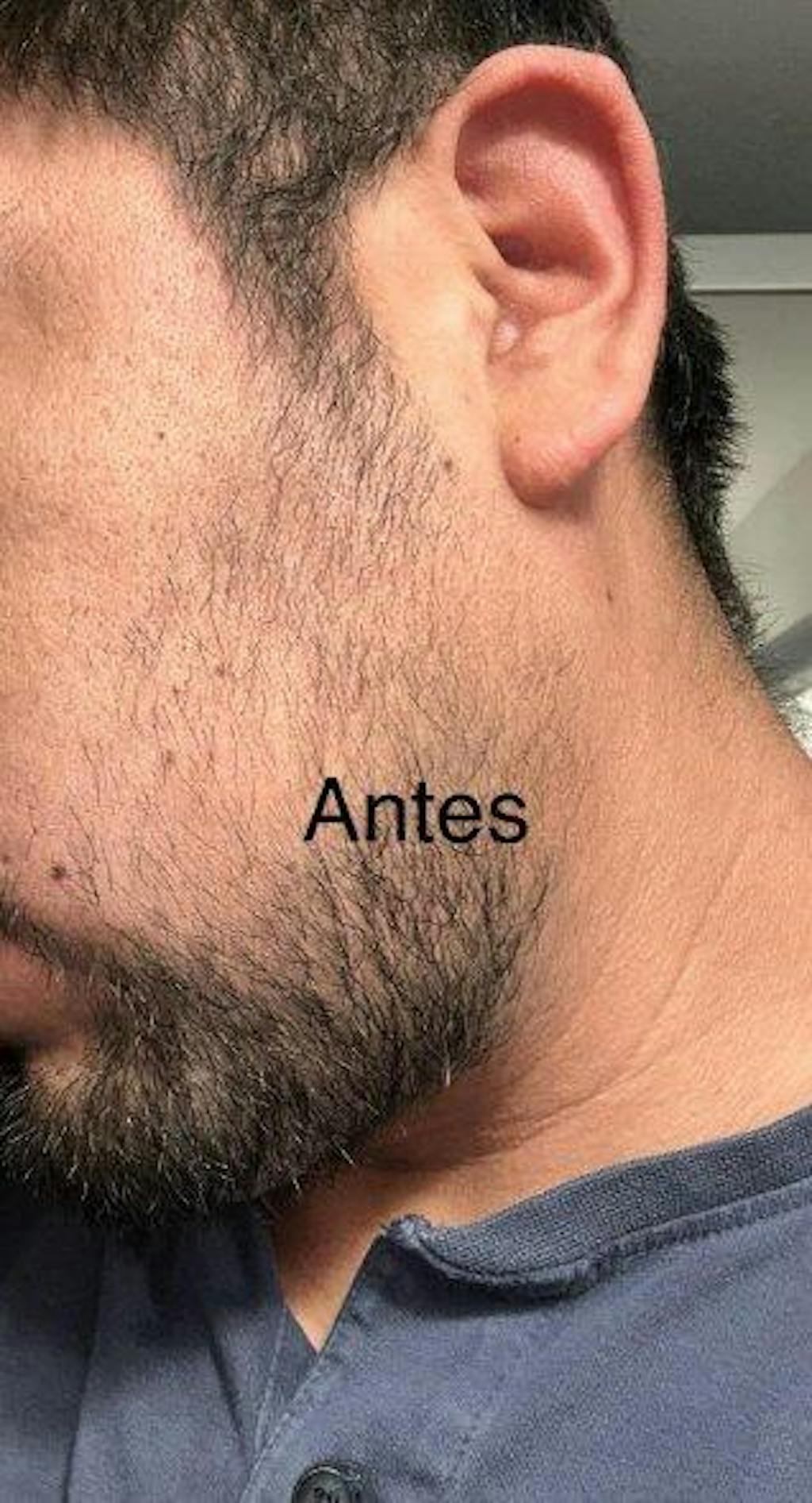 Advanced Hair Growth Roll-On Serum – Aparthy