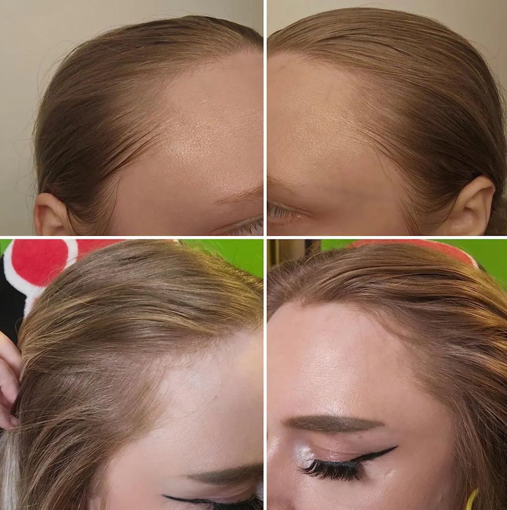 Advanced Hair Growth Roll-On Serum – Aparthy