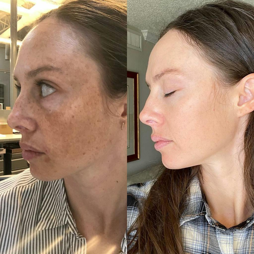 Artemis LED Complete System