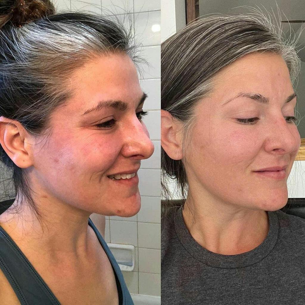 Artemis LED Mask & Neck System