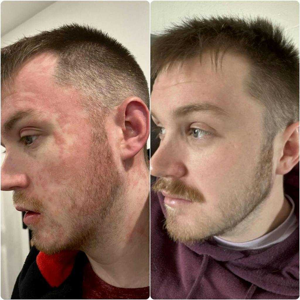 Artemis LED Mask & Neck System