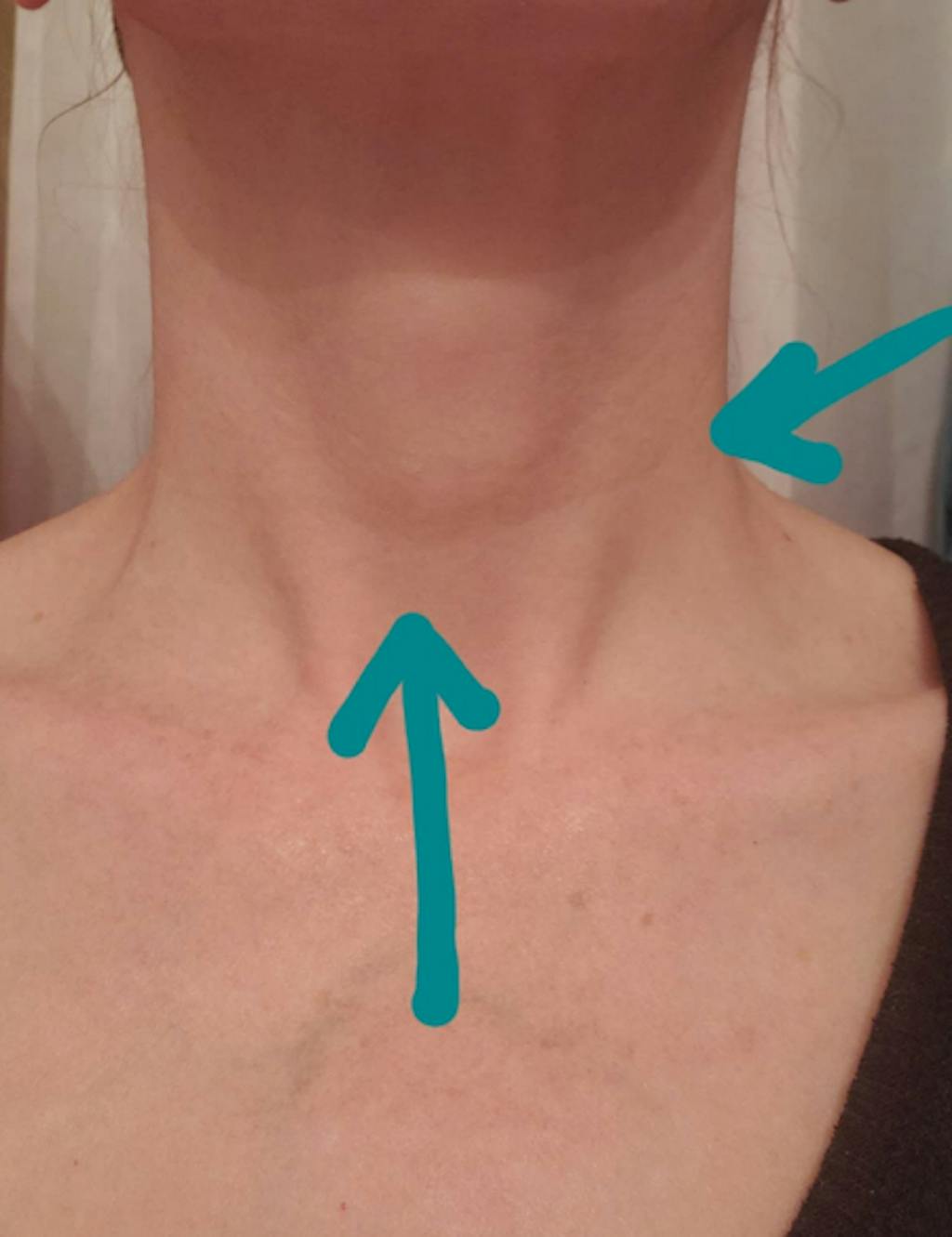 The Instant Neck Lift l No Pain Neck Lift Stretch Bands – Balma Home