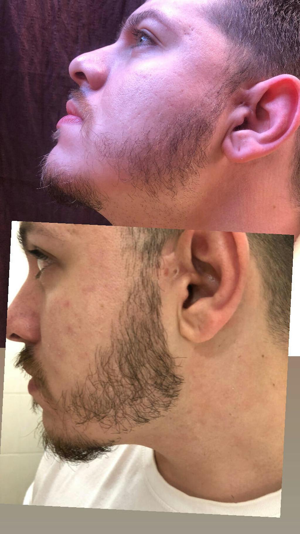 Kit Para Crescer Barba Rápido (60 dias de uso) - Barba Brasil | Barba ...