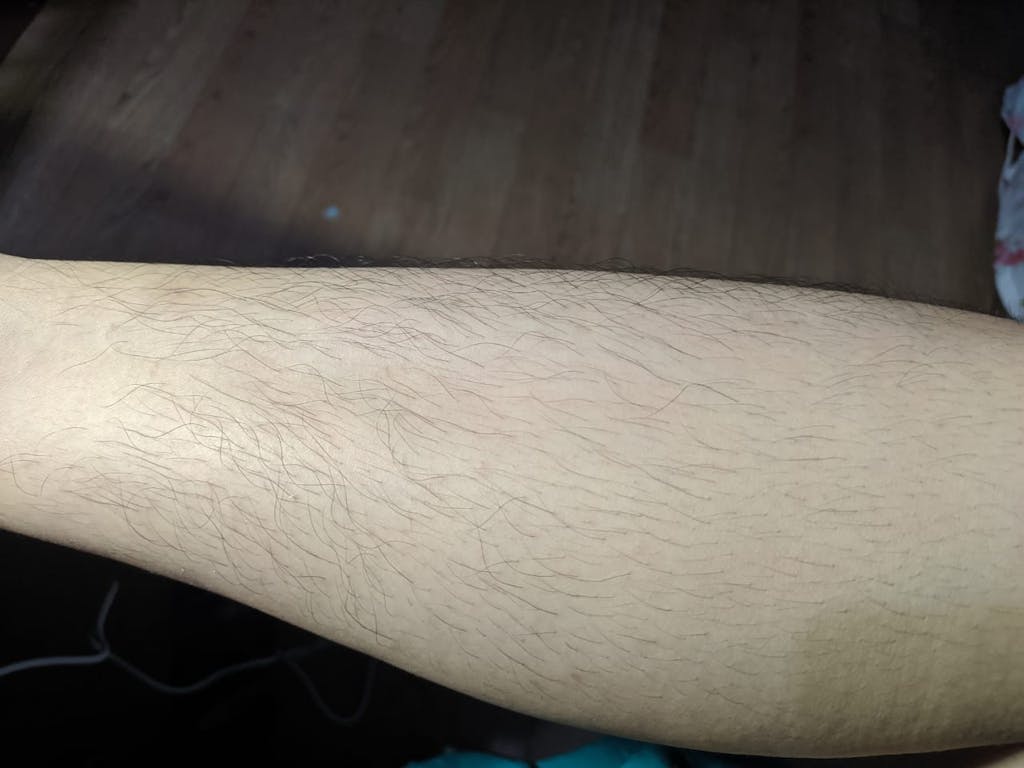 Bare Basics Pro - IPL Laser Hair Removal Handset – Bare Basics IPL