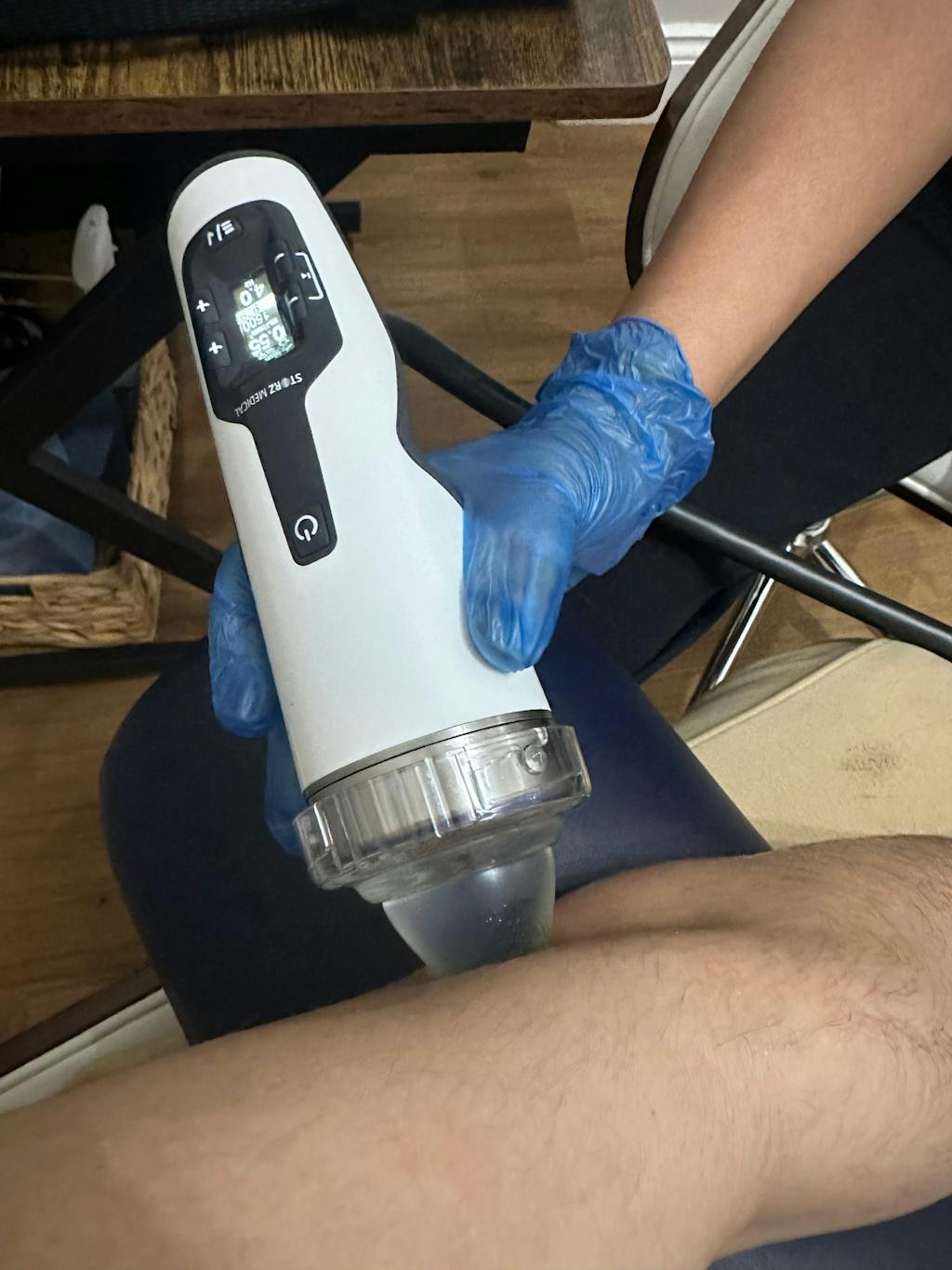Shockwave Therapy | De Quervain's Tenosynovitis – Be Vibrant Physio