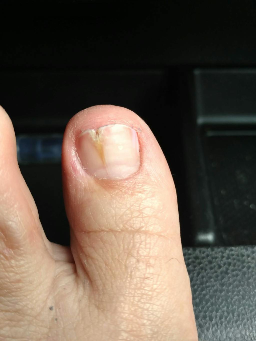 CND - Rescue RXX 0.125 oz - Nail Treatment - CNDM-RXXsmall - Beyond Polish