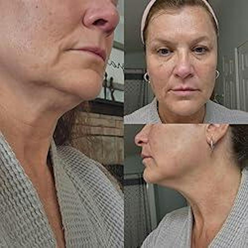 Cellu - Skincare simplified, results dramatically amplified