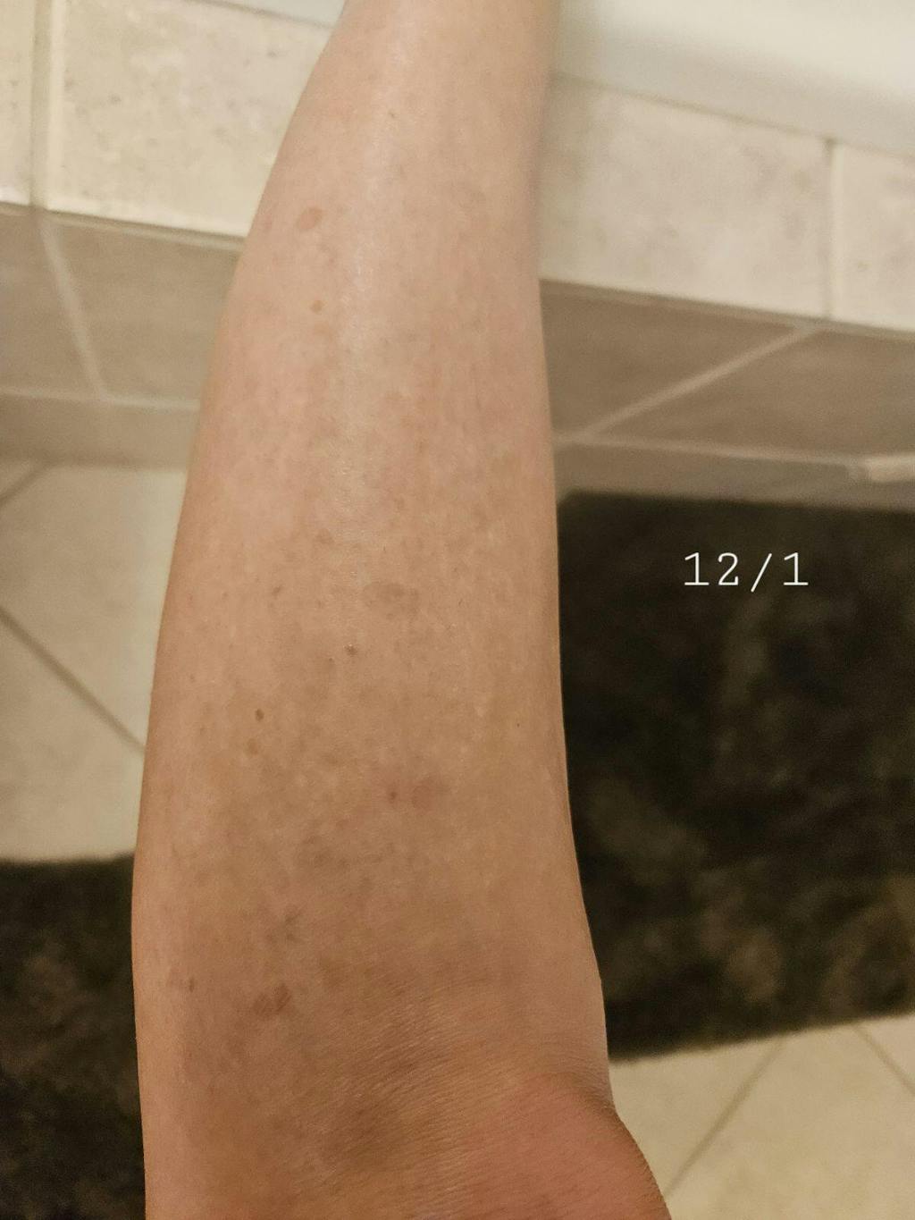 Celluma PRO | LED Light Therapy for Acne, Wrinkles and Pain