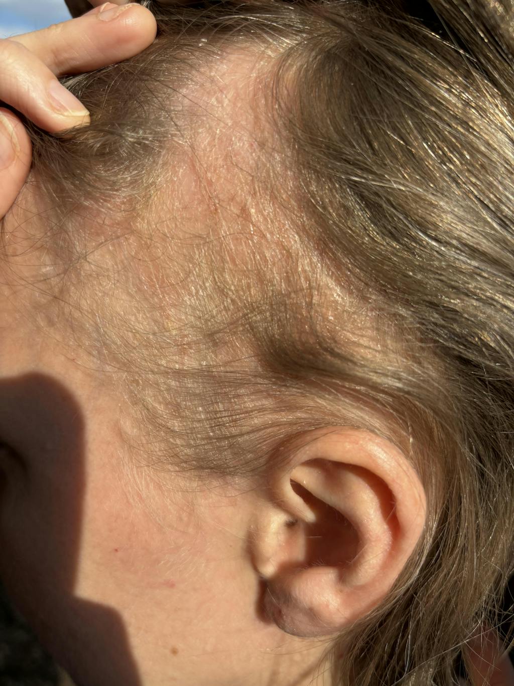 Chāmpo® | Pitta growth serum 50ml