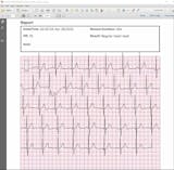 Checkme DuoEK S ECG Monitor