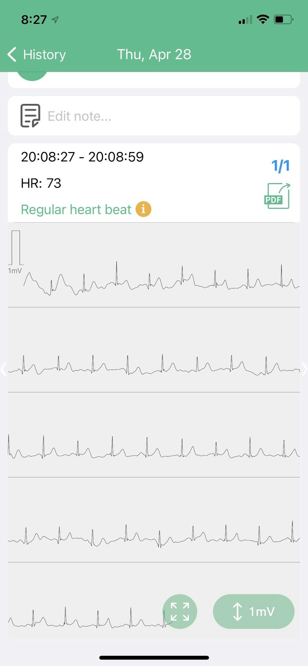 Checkme DuoEK S ECG Monitor