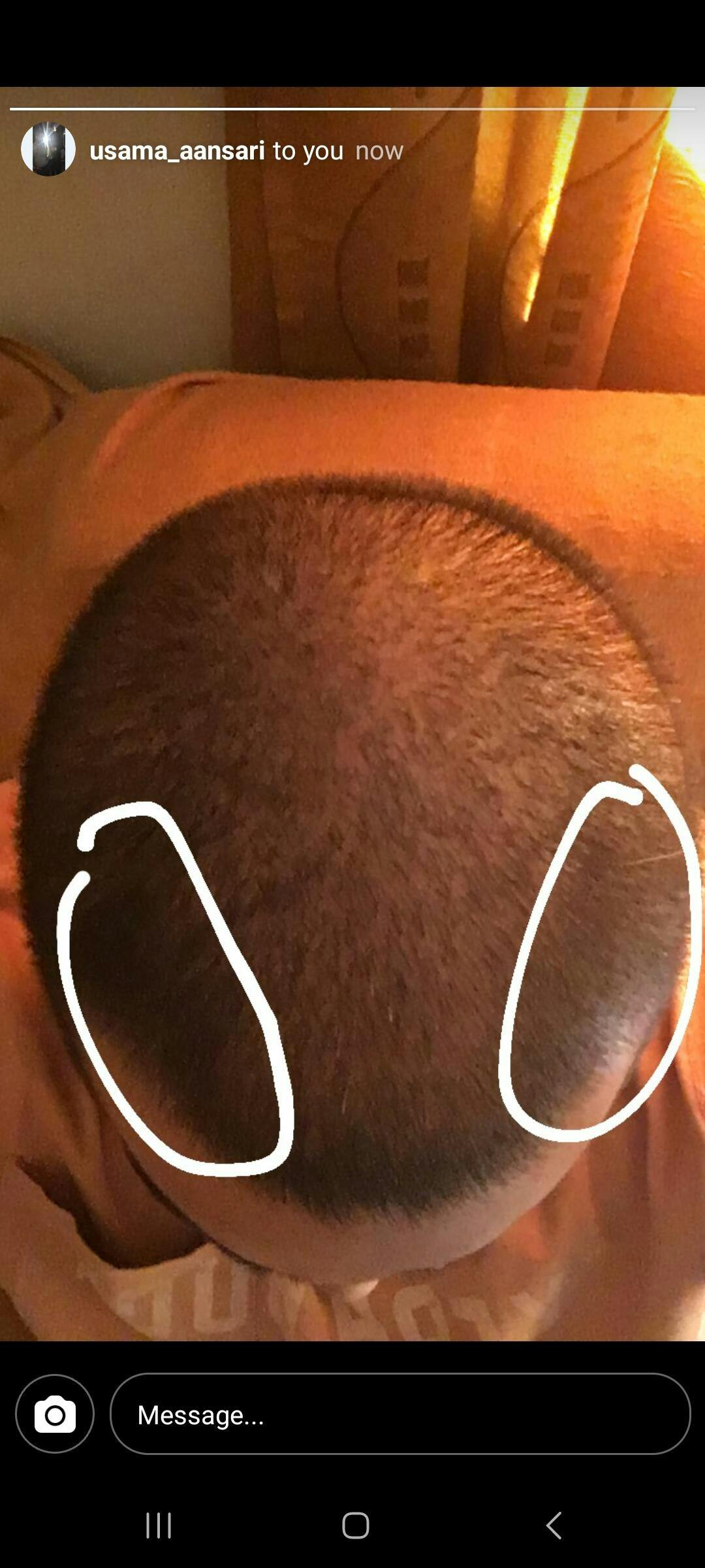 Buy Balchar Oil Online at Best Price in Pakistan - ChiltanPure