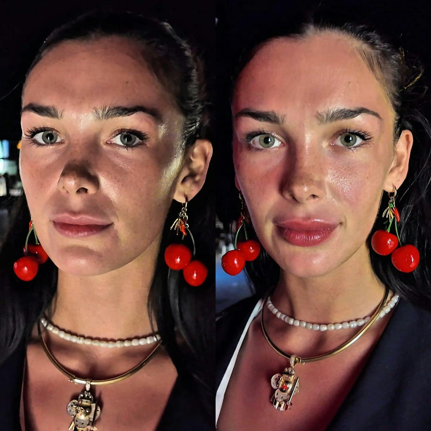 Powiększacz do ust Clementa