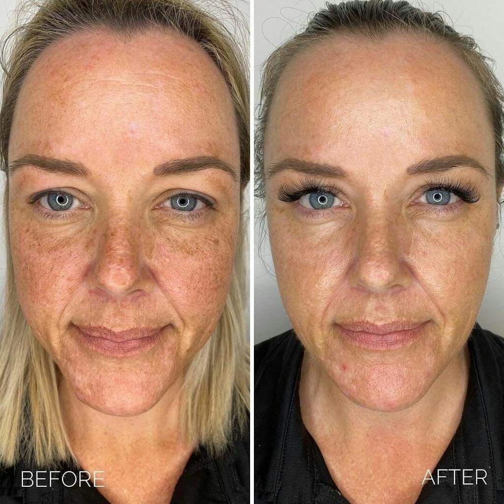 Cleolight™ LED Mask