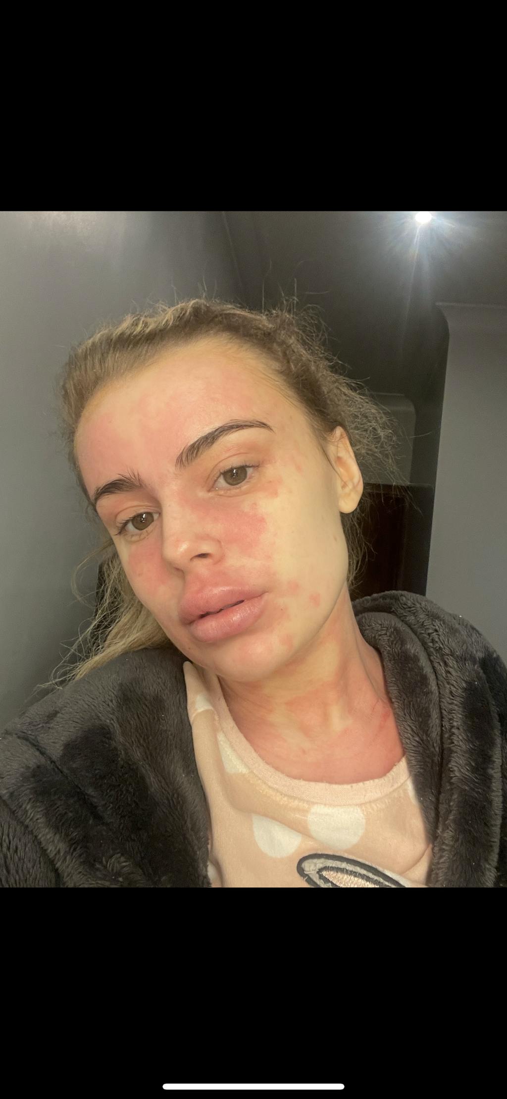 Cooling Scratch Star | Safe Eczema Treatment – Cosi Care ltd