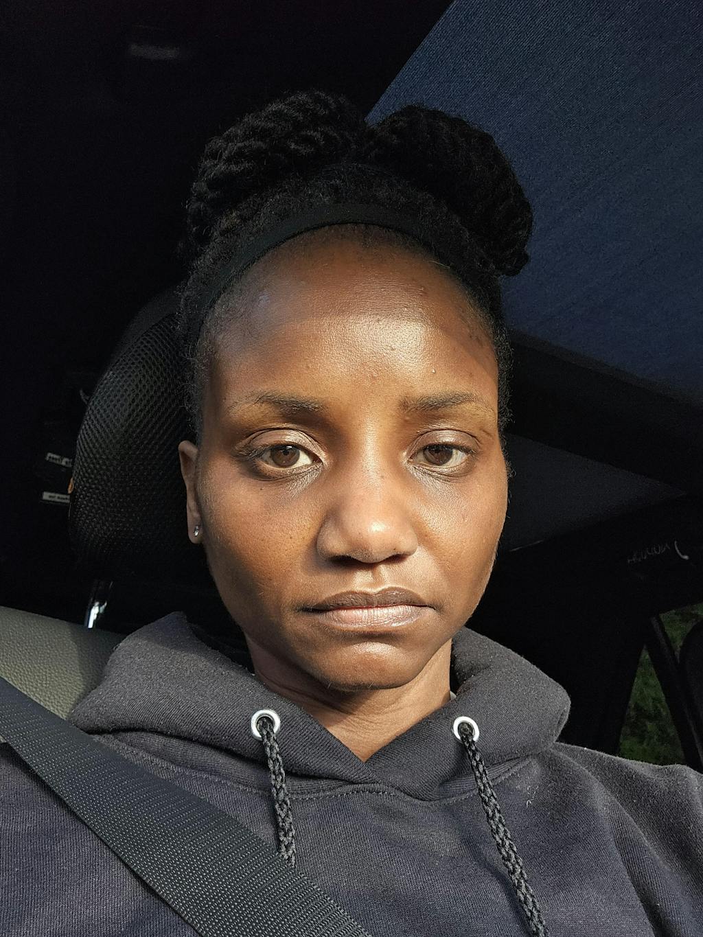 Scar Butter – Donata Skinfood