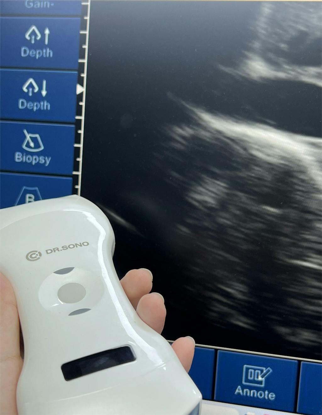 Portable & Wireless Ultrasound Scanner | DR.SONO