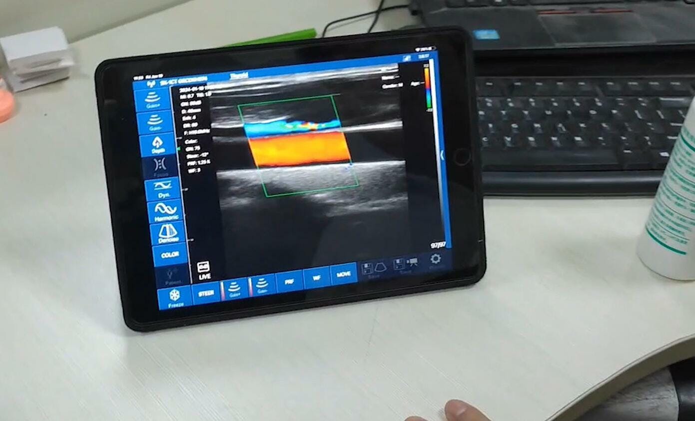 Portable & Wireless Ultrasound Scanner | DR.SONO