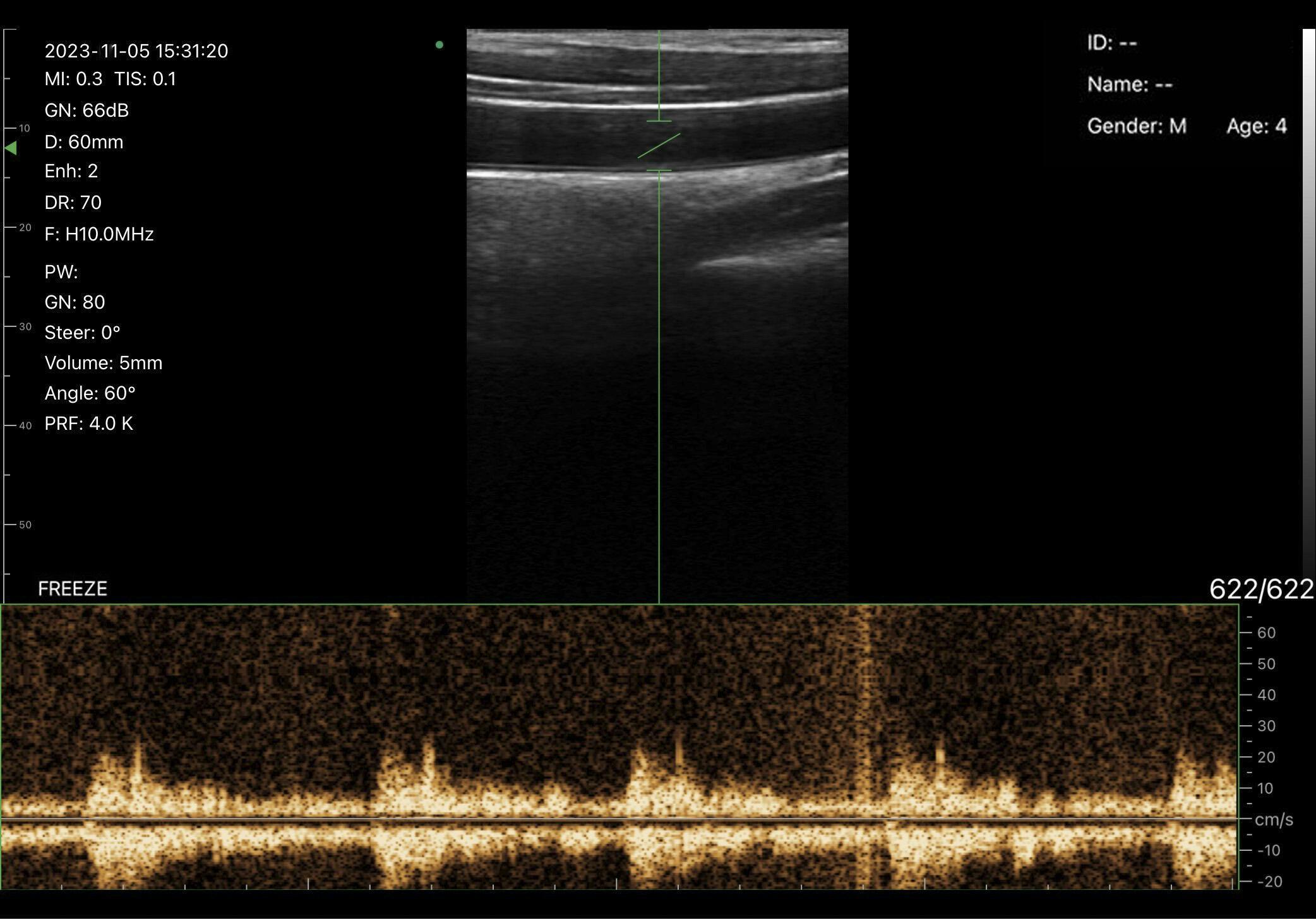 Portable & Wireless Ultrasound Scanner | DR.SONO