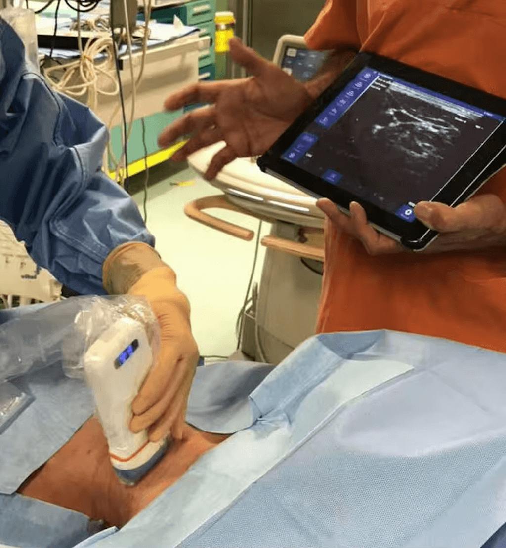 Portable Wireless Linear Probe Ultrasound Scanner | DR.SONO®