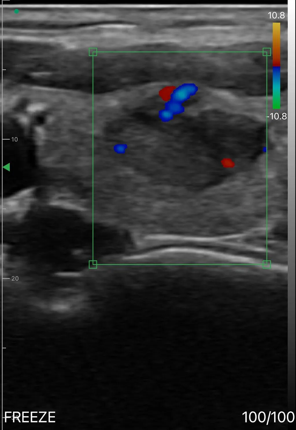 Portable Wireless Linear Probe Ultrasound Scanner | DR.SONO®