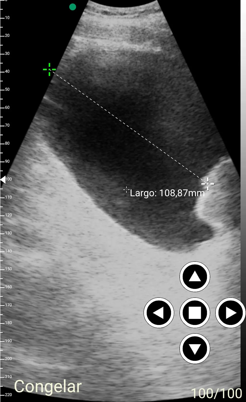 EagleView Dual-Head Wireless Portable Doppler Ultrasound