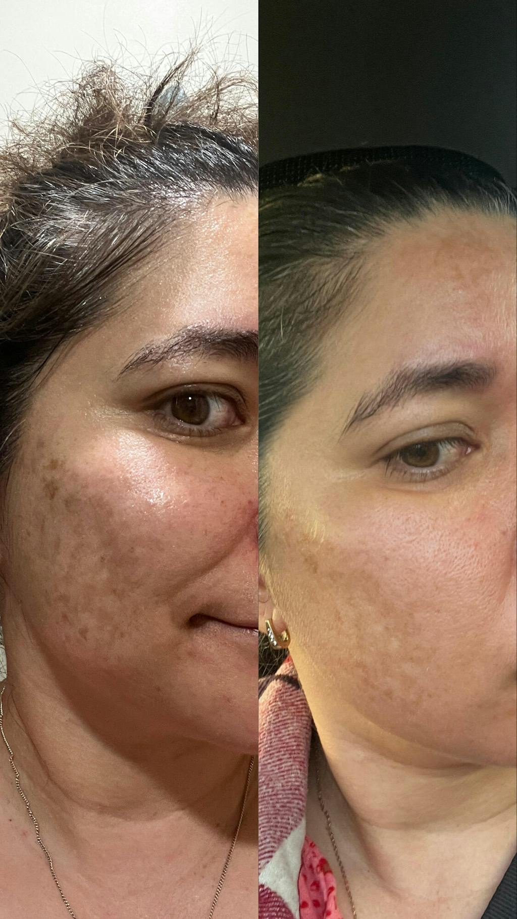 Beauty Reset Drops | Bakuchiol Retinol Alternative | Edible Beauty ...