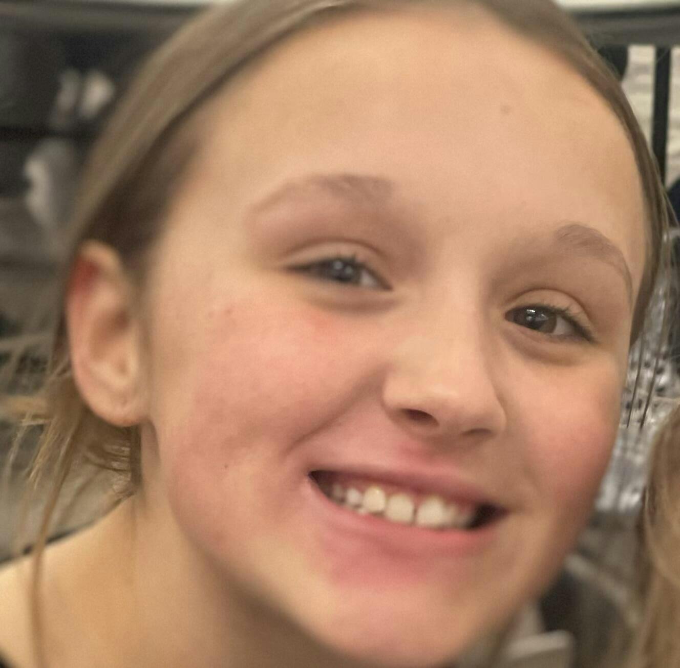 EMUAIDMAX® Maximum Strength Ointment | EMUAID® Official Site