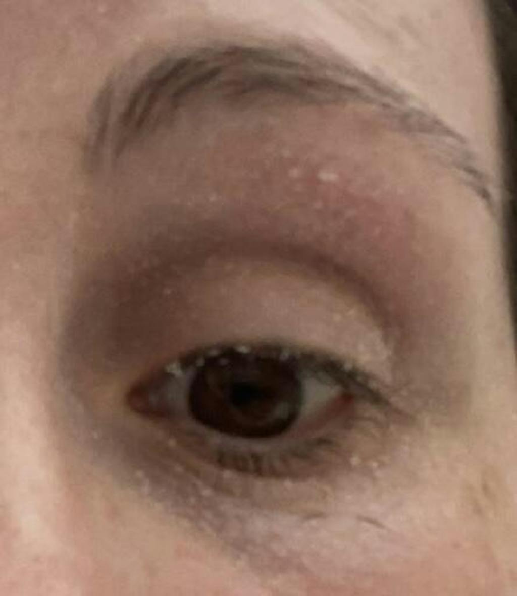 Epaderm Ointment – Epaderm.com.au