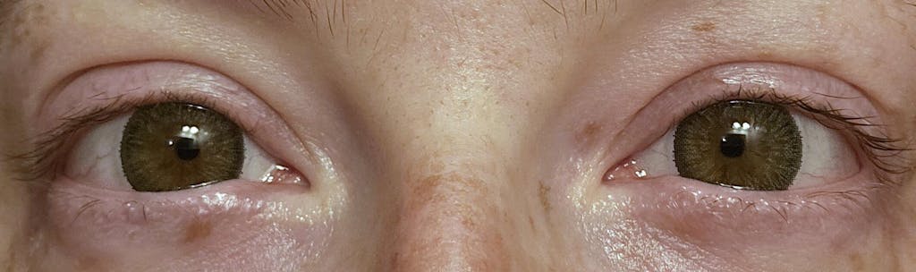 Buy EyeCandys Pink Label Shade Pink Color Contacts | EyeCandys