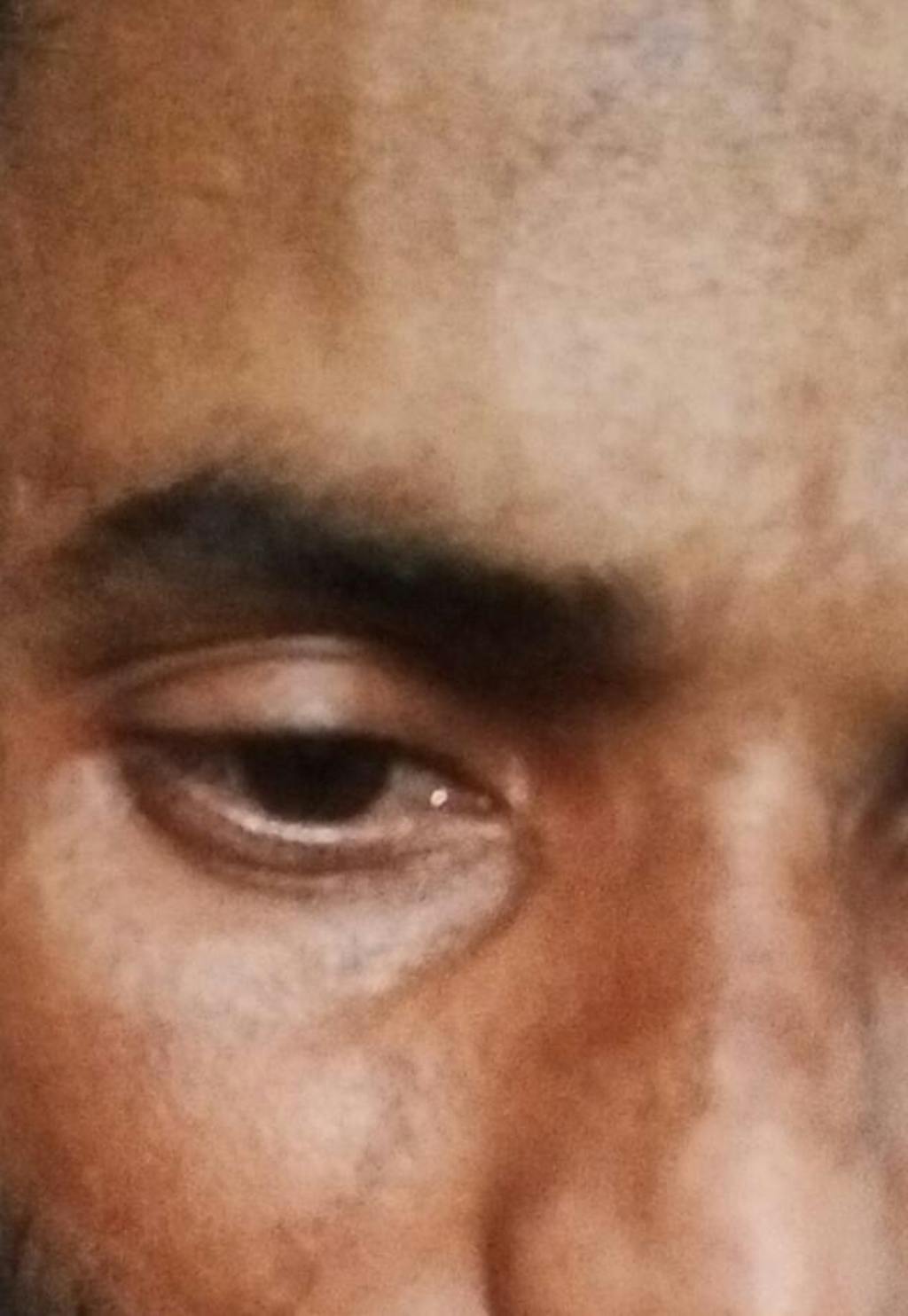 Buy Skarfix-TX | Hyper Pigmentation & Melasma Treatment – Fixderma Skincare