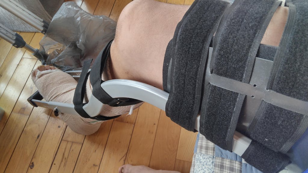 Reviews – Freedom Leg brace