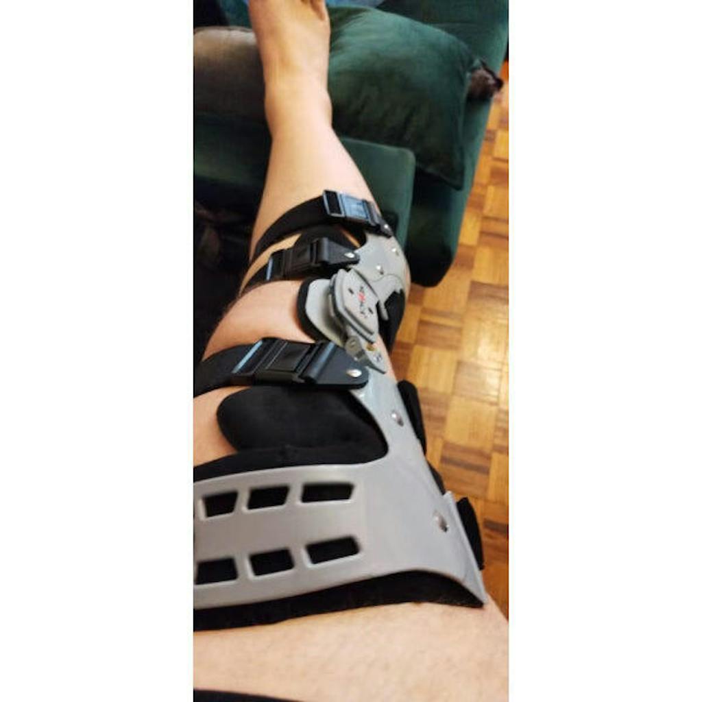 ArthroGuard™ | Osteoarthritis Unloader Knee Brace | Medial & Lateral S ...