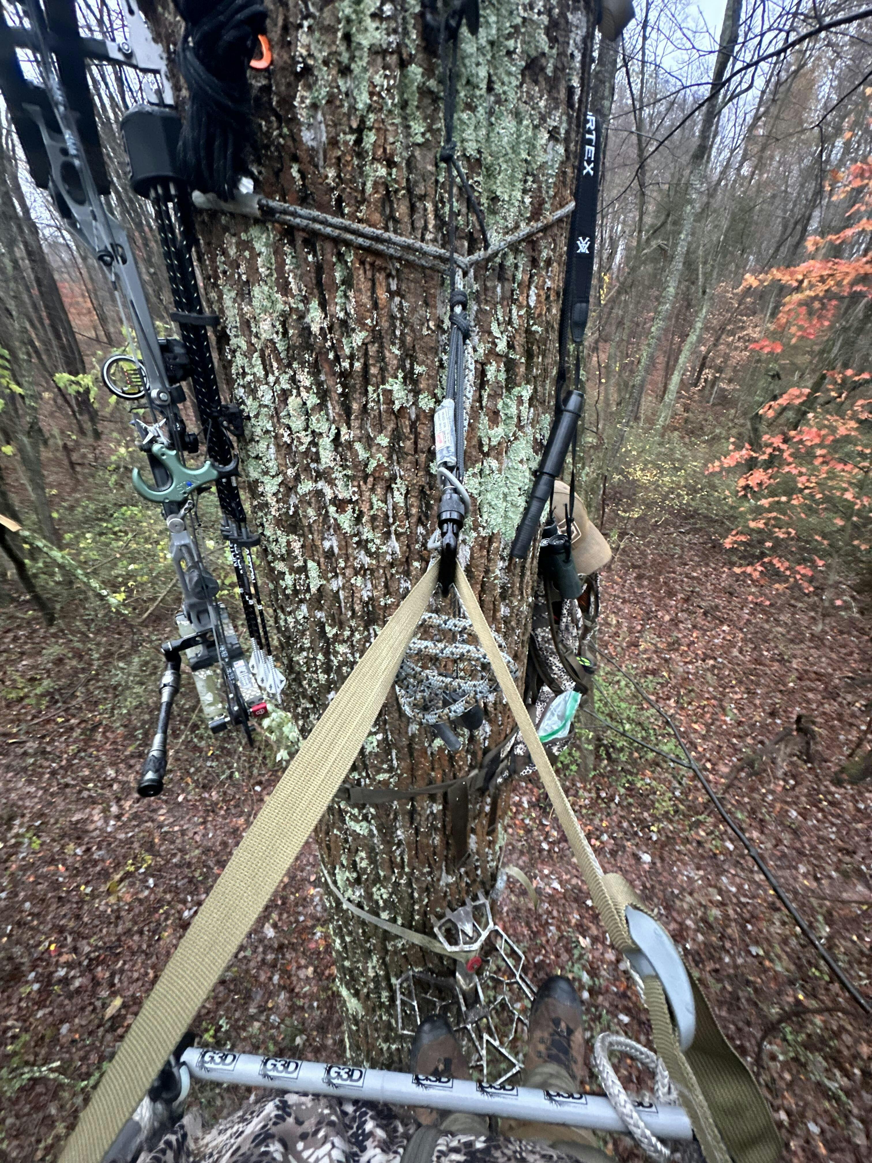 Hip Pinch Eliminator – Genesis 3D Printing, LLC