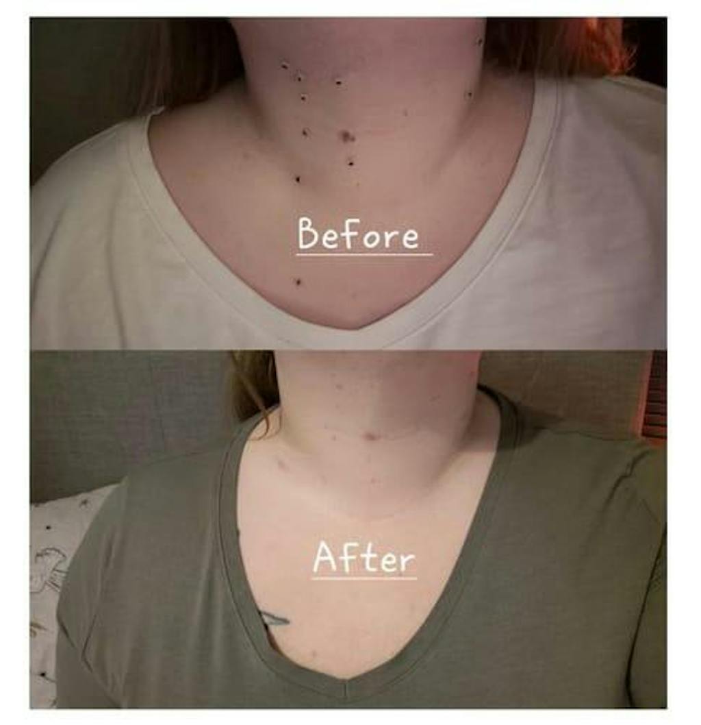 TagBuddy Pro - No More Skin Tags – Glomisk