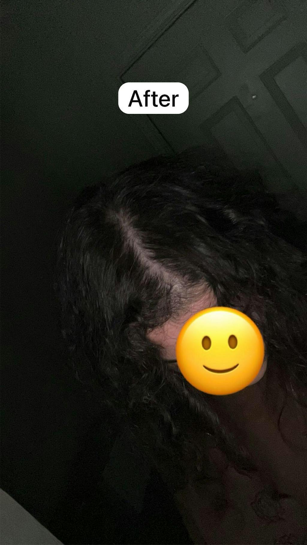 GolâbGrowth Bundle – Golâb Beauty