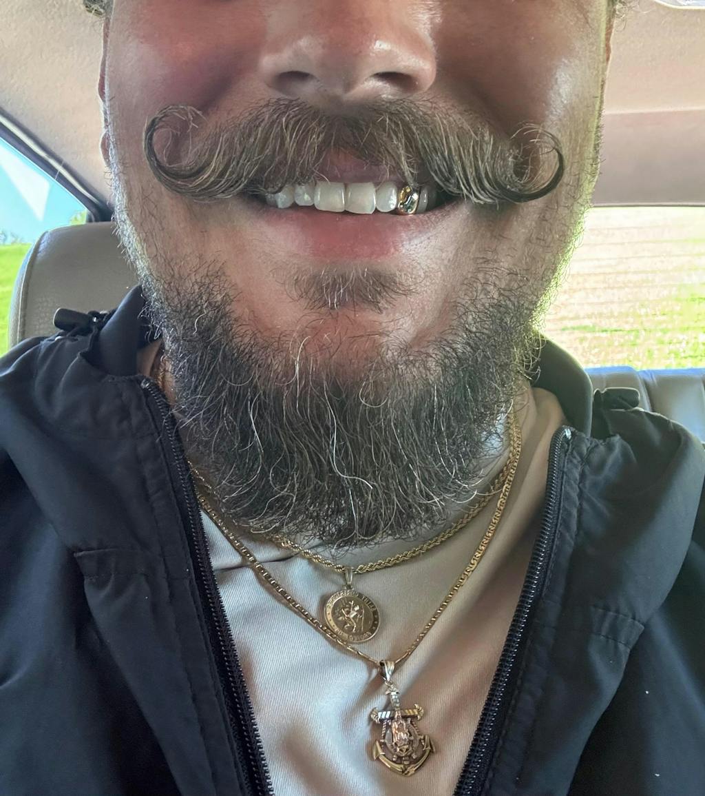 Custom Gold Grillz | 10K, 14K & 18K Gold | Gold Teeth America