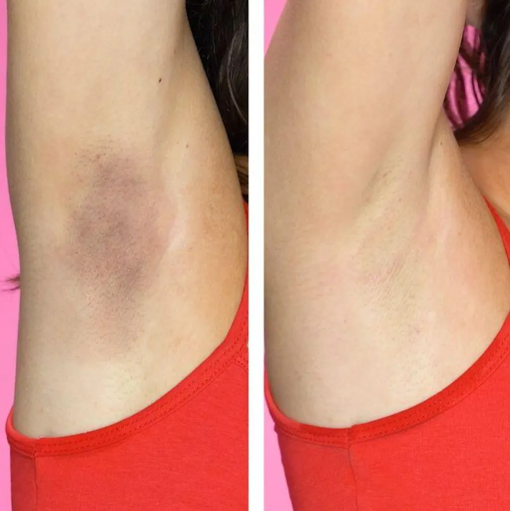 India's First Glutathione & Antioxidants Infused Advanced Private Part ...