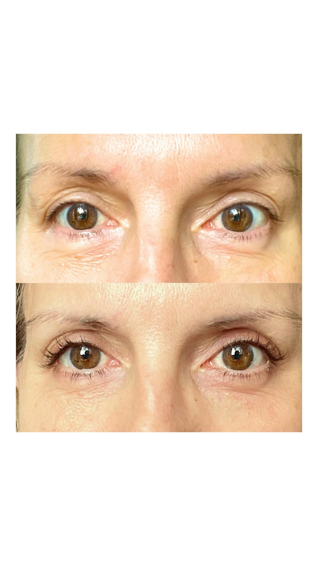 Lash Therapy – Hello Skincare