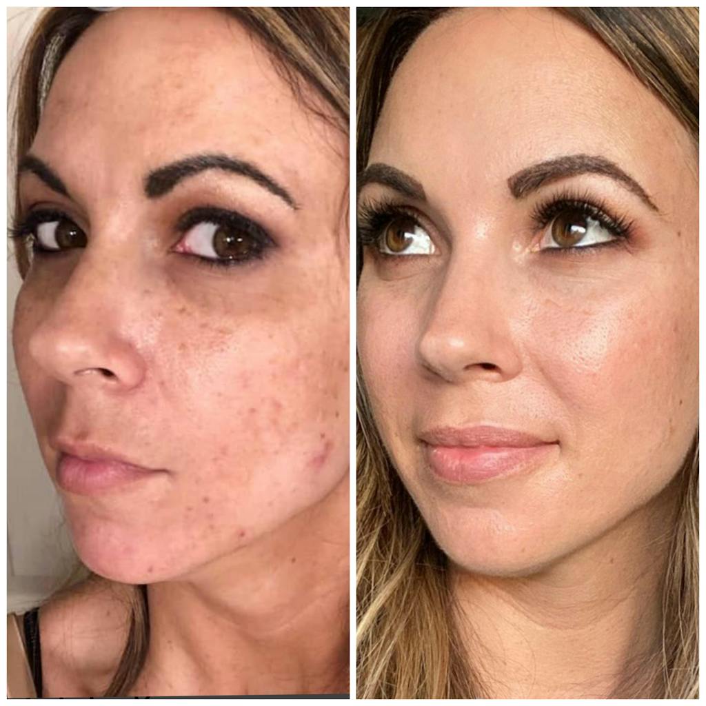 Product Collections – Hello Skincare