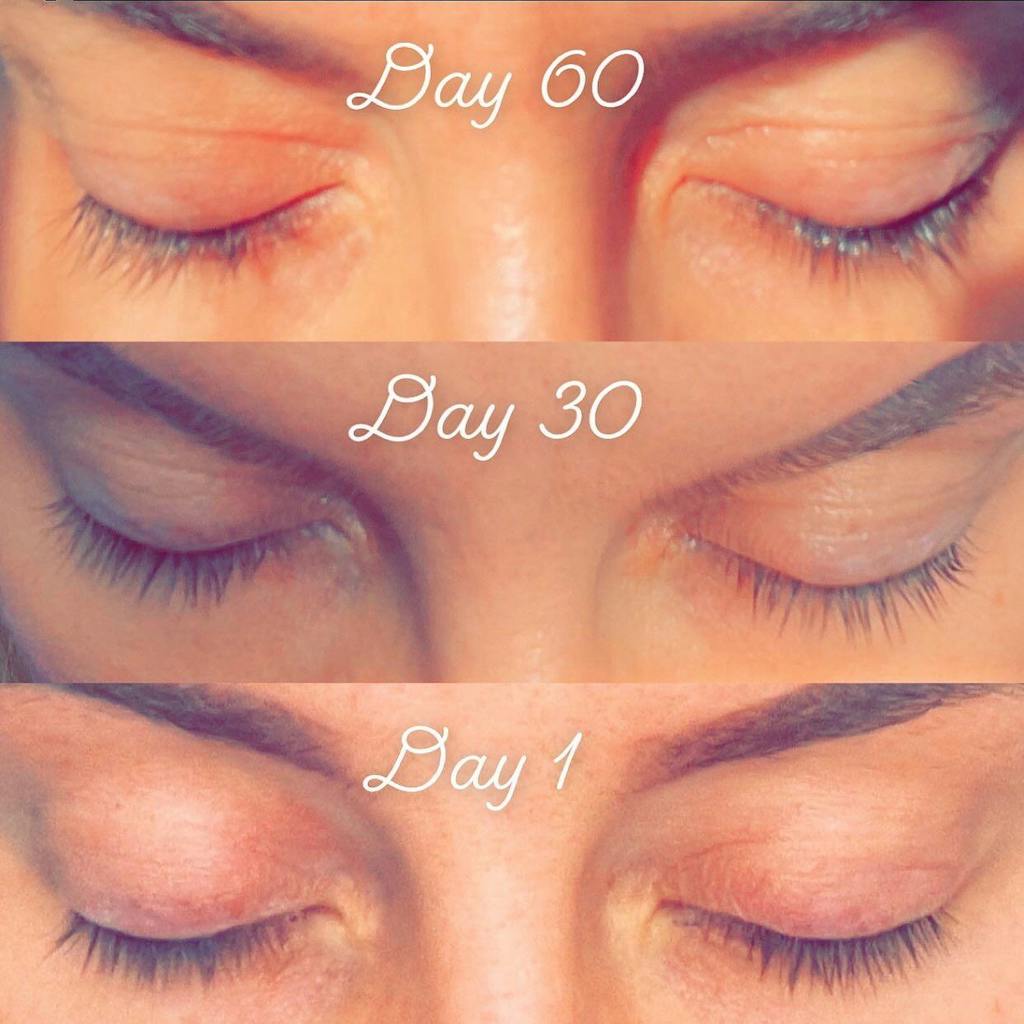 Lash Therapy – Hello Skincare