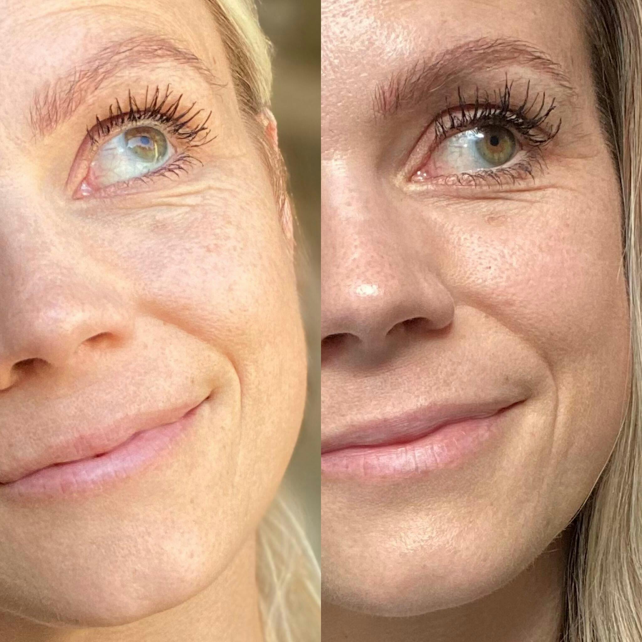 Lash Therapy – Hello Skincare