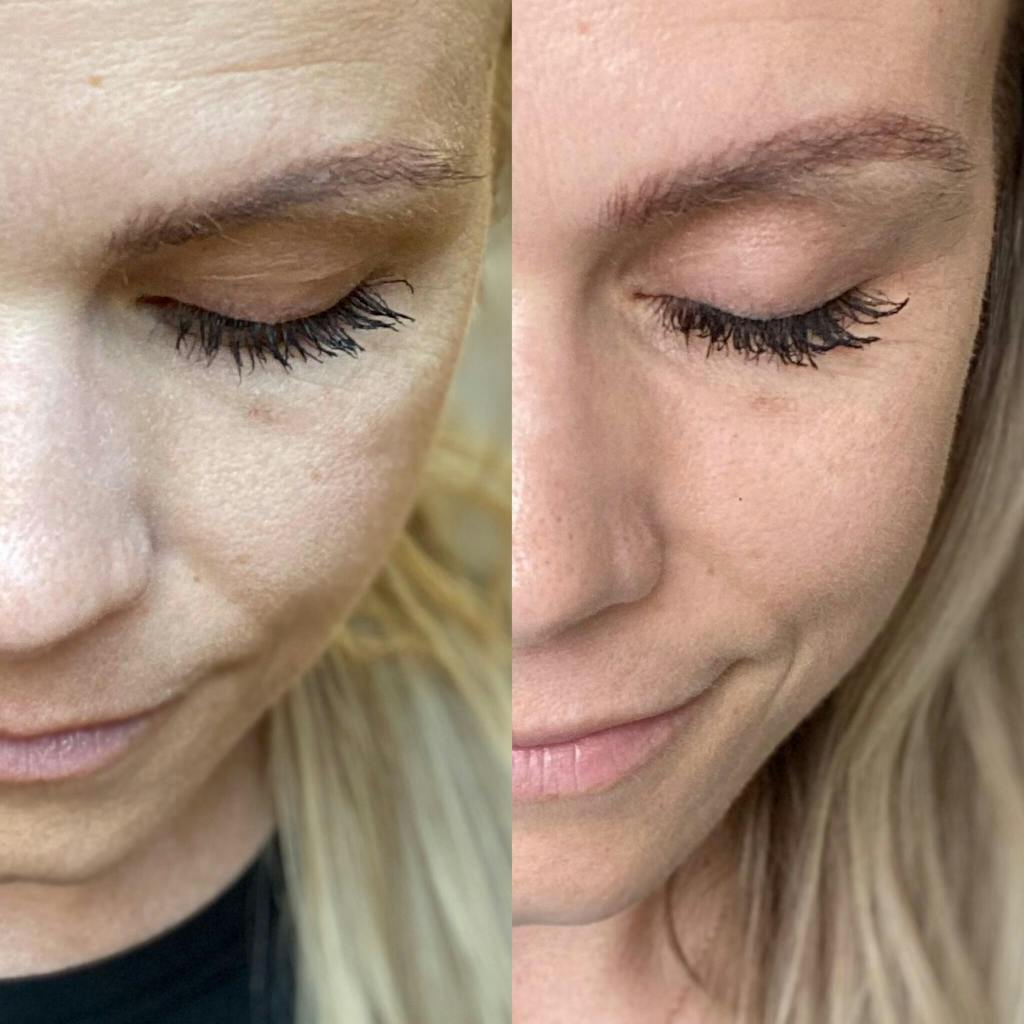 Lash Therapy – Hello Skincare