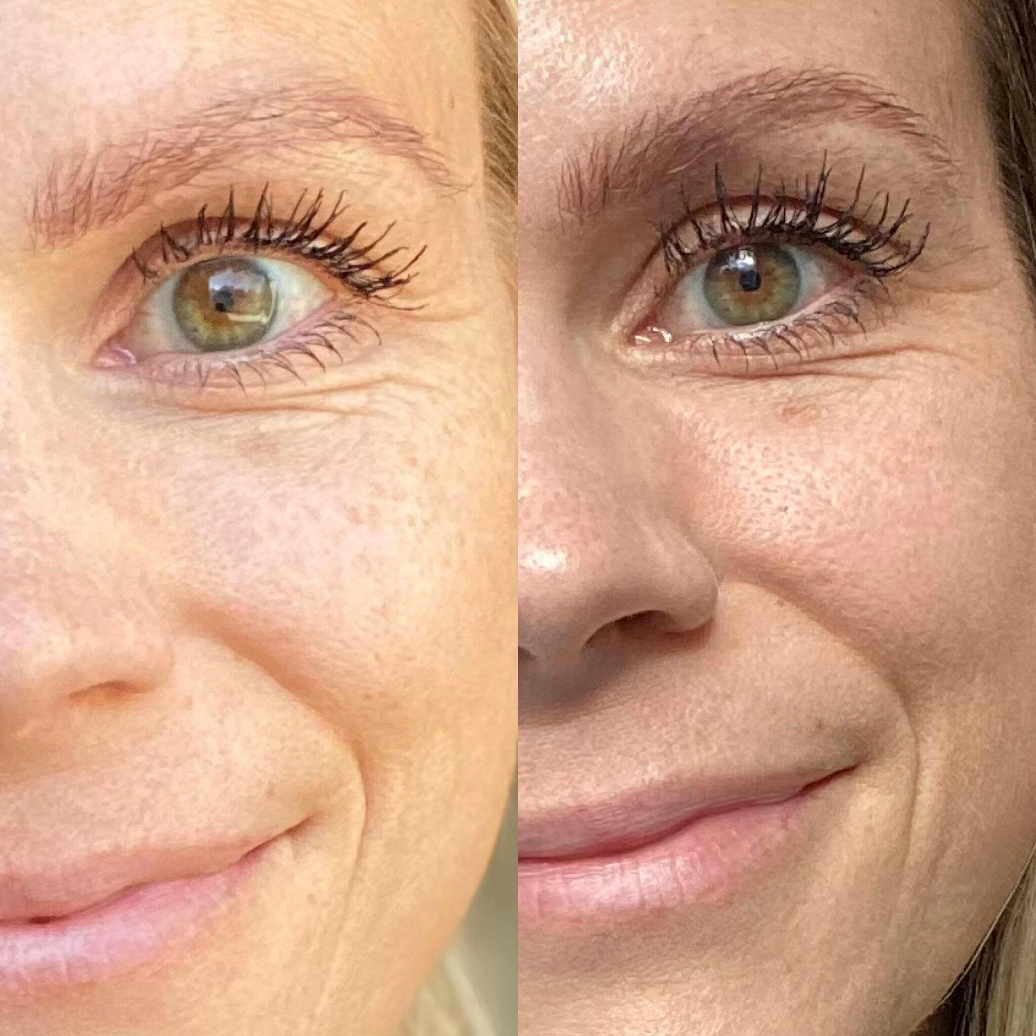 Lash Therapy – Hello Skincare