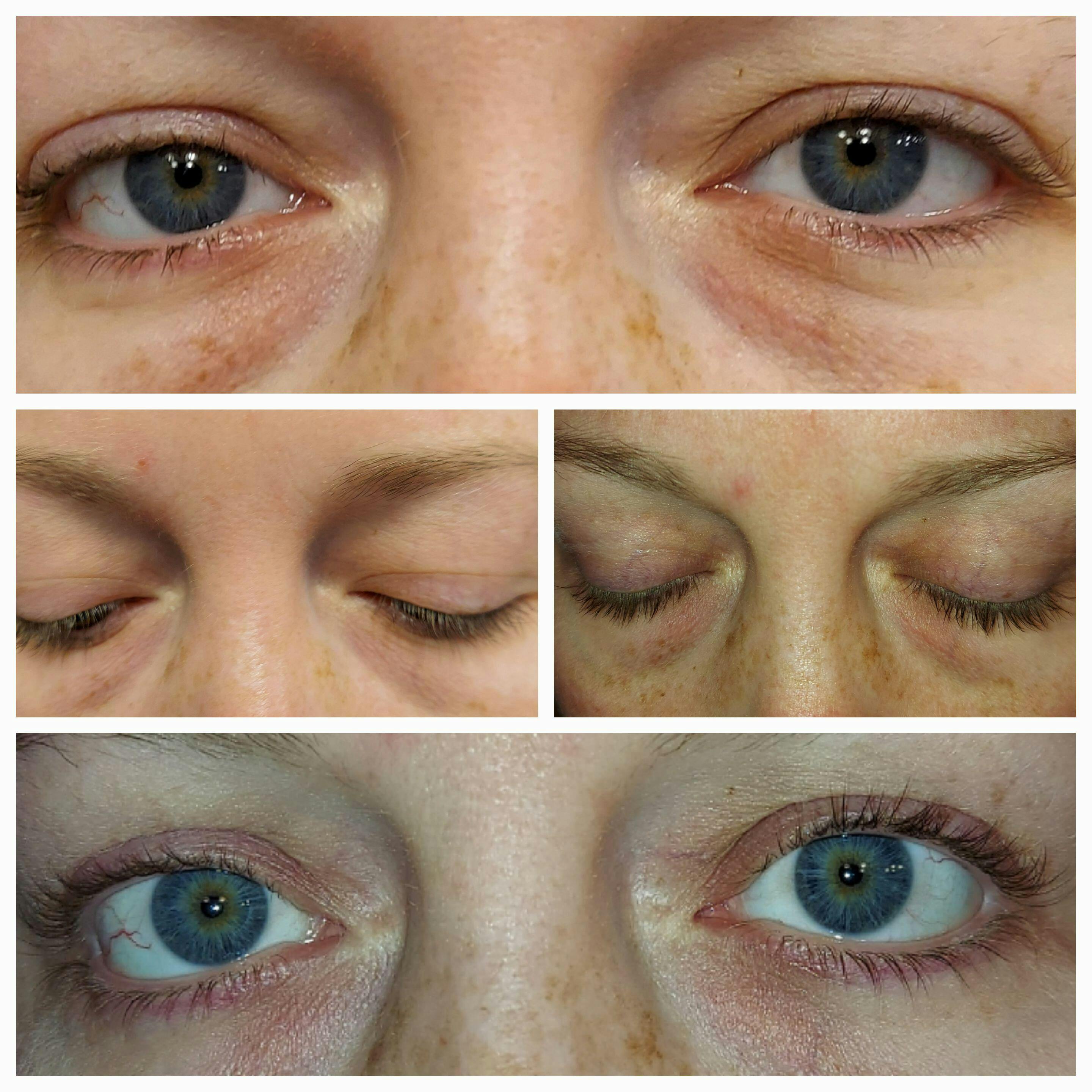 Lash Therapy – Hello Skincare