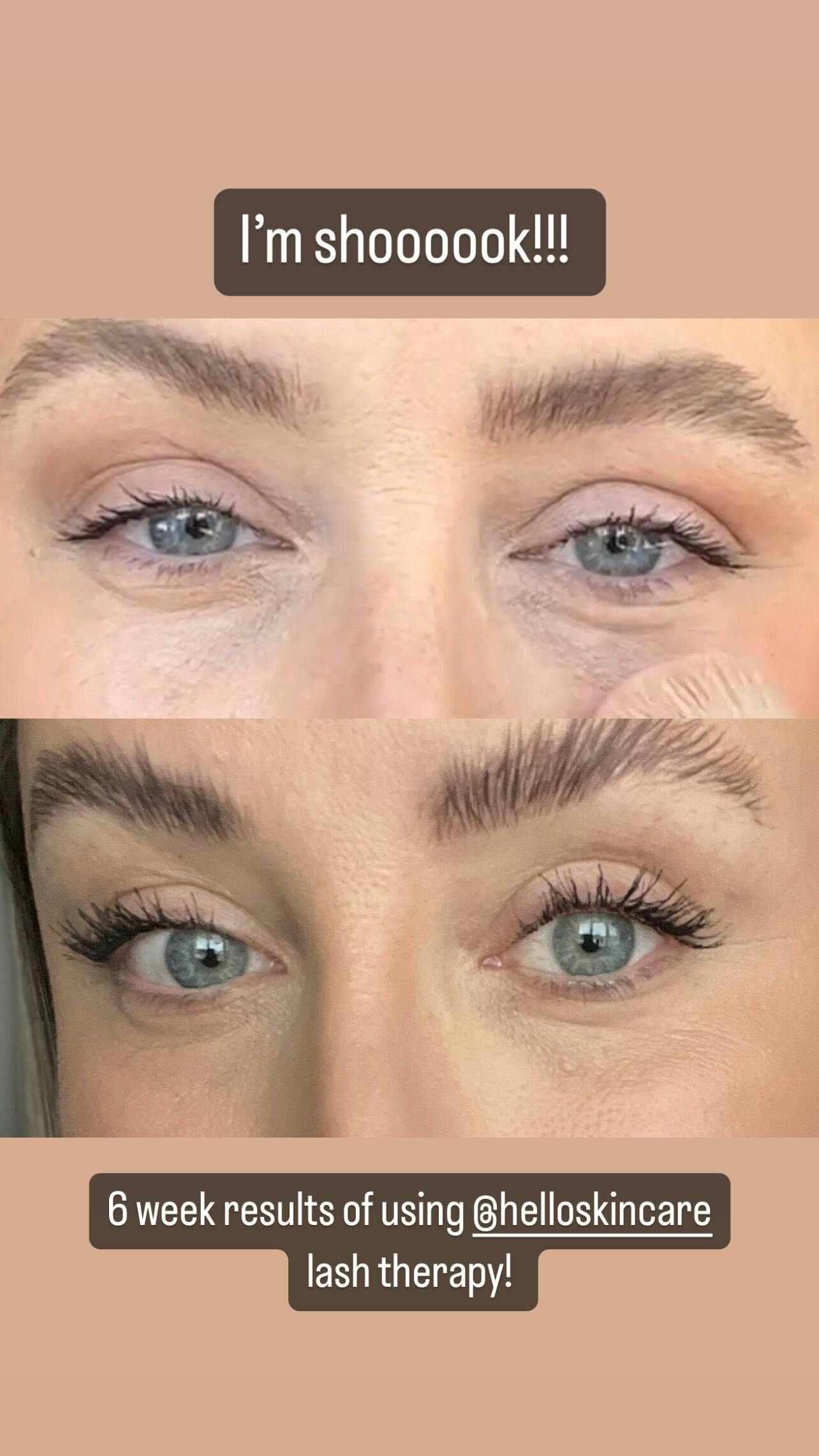 Lash Therapy – Hello Skincare